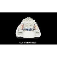 China Biocompatible Dental Metal Framework Cobalt-Chromium Titanium Precision Fit for Removable Partial Dentures for sale