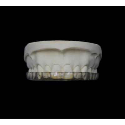 China Dental Contention Splint Occlusal Splint For TMJ Disorder Relief Bruxism Protection for sale