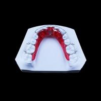 China Customizable Hyrax Palatal Expander for Crossbite Correction Metal Orthodontic Appliance for sale