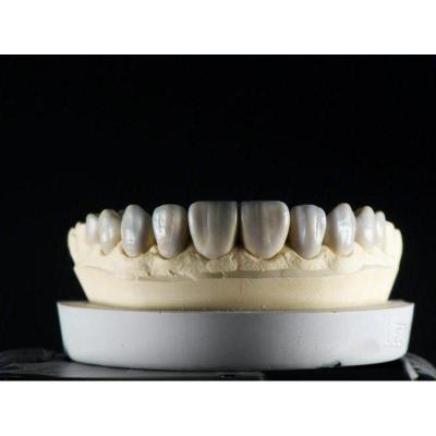 China High Precision Diagnostic Wax Up Dental Lab Wax Up Customization for sale
