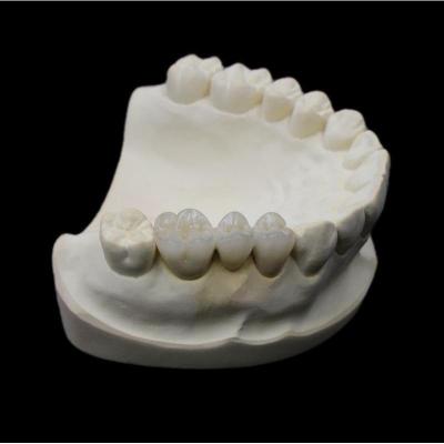 China Ceramic Powder PFM Crown Porcelain Fused To Metal Crown Dental Restoration for sale