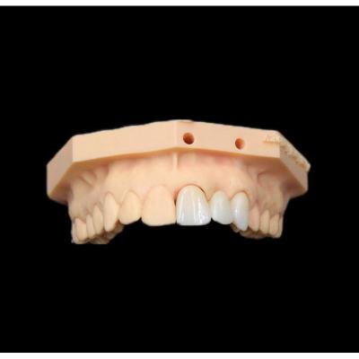 China Zircon Crown Dental Restoration With Natural Tooth Shade Transparent for sale