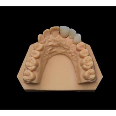 China Translucent Finish Dental Zircon Restoration Dental Digital Lab With 7.5 Mohs Hardness for sale