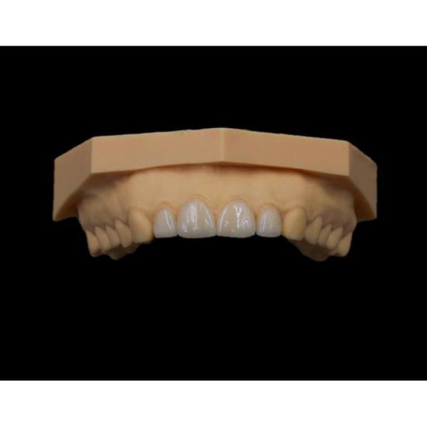 Quality High Translucency Dental Emax Crown Superior Esthetics For Dental Restorations for sale