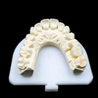 Quality 360MPa-400MPa Flexural Emax Inlay Dental Restoration High Translucency for sale