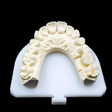 Quality 360MPa-400MPa Flexural Emax Inlay Dental Restoration High Translucency for sale