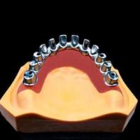 Quality Titanium Individual Abutment Dental Implant 10mm Length And Sandblasted And Acid for sale