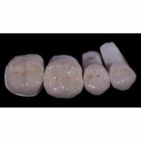 Quality Durable Composite Dental Crown For Die Preparation And Pontic Restoration for sale