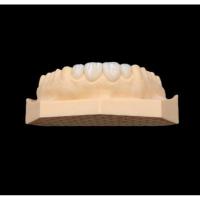 Quality High Durability Dental Veneers Natural Tooth Shade Glossy Surface for sale
