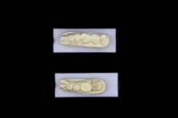 Quality Minimally Invasive Dental Composite Inlay Posterior Teeth Restoration for sale