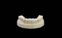 Quality Lithium Disilicate All Ceramic Emax Crown Dental Restoration Proven Strength for sale