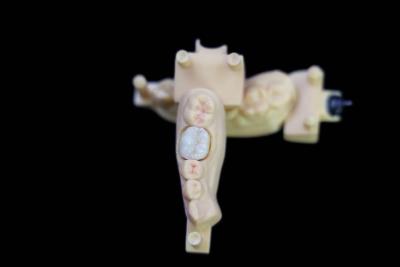 China High Hardness Zircon Crown Dental Restoration With Natural Tooth Shade for sale