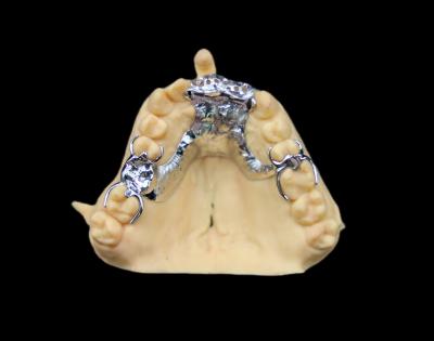 China Nickel Chromium Dental Metal Framework CAD CAM Fit Digital Processing for sale