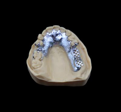 China Corrosion Resistant Cast Metal Framework Partial CAD CAM Fit for sale