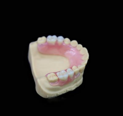 China Flexible Partial Denture Biocompatible Nylon Resin Metal Free And High Flexibility for sale