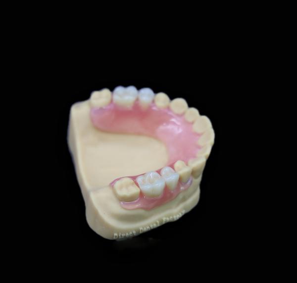 Quality Flexible Partial Denture Biocompatible Nylon Resin Metal Free And High Flexibility for sale