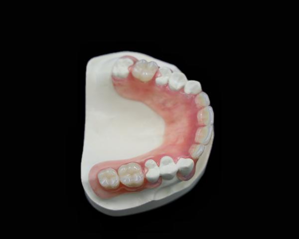 Quality China Dental Outsourcing Valplast Partial With Biocompatible Nylon Resin for sale