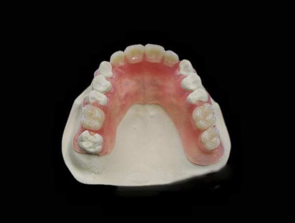 Quality Nonporous Dental Valplast Biocompatible Custom Made Flexible Partial Denture for sale