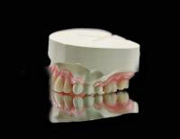 China Translucent Pink Valplast Flexible Partial Denture Biocompatible Nylon Resin Metal-Free 1950s for sale