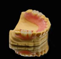 Quality Translucent Pink Valplast Denture Flexible Partial Biocompatible Nylon Resin for sale