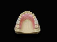 Quality Nylon Resin Valplast Flexible Partial Metal Free High Flexibility Valplast Teeth for sale
