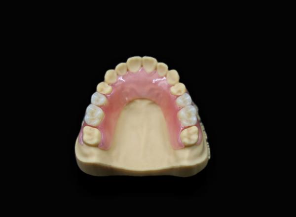 Quality Nylon Resin Valplast Flexible Partial Metal Free High Flexibility Valplast Teeth for sale