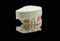 Quality Biocompatible China Dental Lab Valplast Dental Partials Flexible Partial Denture for sale