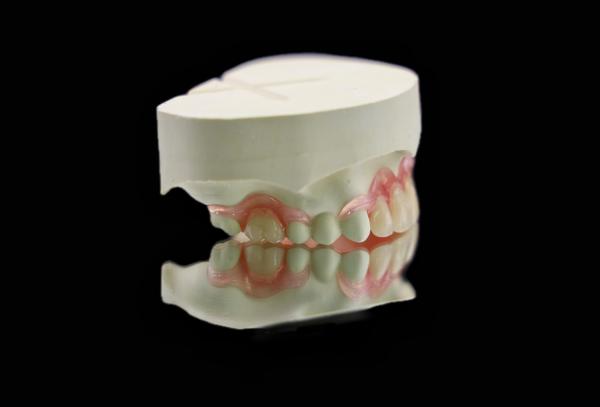 Quality Biocompatible China Dental Lab Valplast Dental Partials Flexible Partial Denture for sale