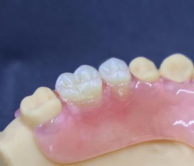 China Removable Adjusting Valplast Partials High Flexibility Chinese Dental Lab for sale