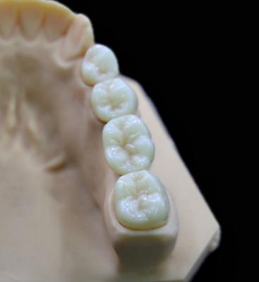 China Full Contour Zirconia Hypoallergenic Dental Lab Zirconia Full Zircon for sale