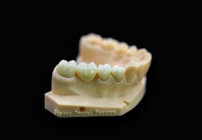 China CAM Milling China Dental Laboratory Zircon Dental Zirconia Metal Free for sale