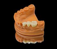Quality Chinese Dental Laboratory Metal Free Dental Full Zirconia Crown CAD CAM Milling for sale