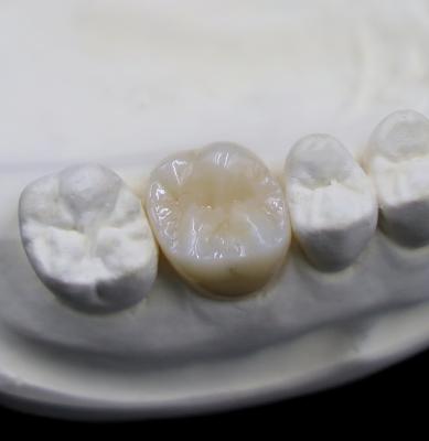 China Zirconia Dental Lab High Flexural Strength Dental Zirconia High Hardness for sale