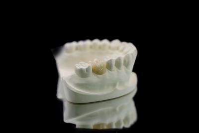 China Hypoallergenic Dental Lab Outsourcing Dental Zircon With CAD / CAM Milling for sale