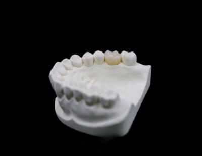 China Zirconia Dental Lab Outsourcing Services CAD/CAM Milling Metal Free for sale