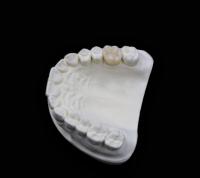 Quality CAD CAM Chinese Dental Lab Dental Zirconia Crowns Full Contour Dental Lab for sale