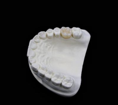 China CAD CAM Chinese Dental Lab Dental Zirconia Crowns Full Contour Dental Lab for sale