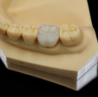 China Dental Lab Zirconia Zircon Veneering Porcelain With Full VITA Shade Compatibility for sale