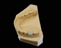 Quality Glossy Surface Dental Zircon Digital Dental Laboratory For Dental Restorations for sale