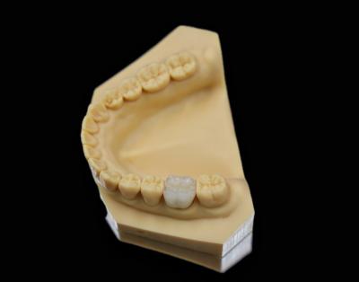 China Glossy Surface Dental Zircon Digital Dental Laboratory For Dental Restorations for sale