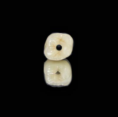 China Dental Implant System Pure Titanium Tapered Body Shape For Prosthodontics for sale