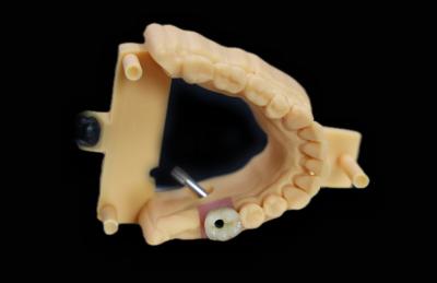 China Commercially Pure Titanium Dental Implants CPTi Dental Implant System for sale