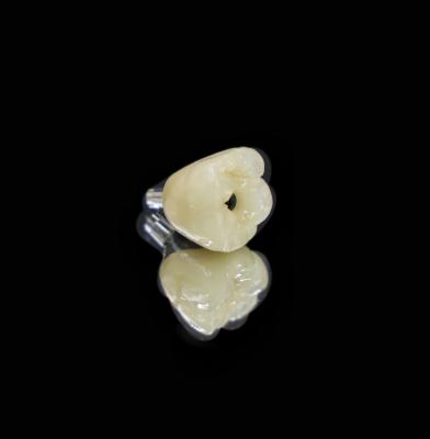 China Prosthodontics China Dental Implant System Screw Retained /Cement Retained for sale
