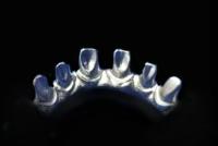 Quality Titanium Digital Dental Solutions Lab 3.75mm-4.5mm Diameter Screw Retained for sale