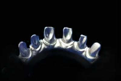 China Titanium Digital Dental Solutions Lab 3.75mm-4.5mm Diameter Screw Retained for sale