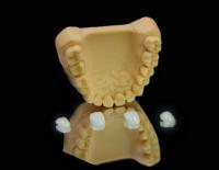 Quality China Dental Lab Veneers Stain Resistance And Minimally Invasive Porcelain for sale
