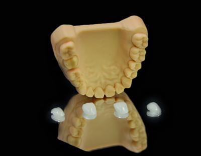 China China Dental Lab Veneers Stain Resistance And Minimally Invasive Porcelain Veneers for sale