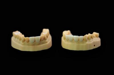 China Custom Anatomical Dental Veneers Porcelain China Dental Outsourcing for sale
