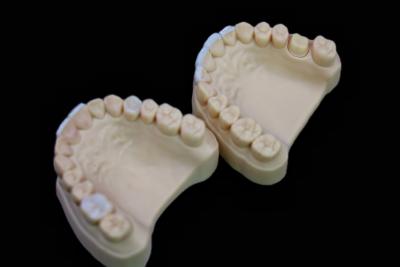 China Minimally Invasive Dental Veneer Porcelain Teeth HT MT LT MO Dental Laboratory China for sale