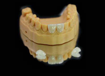 China Prosthesis Dental Veneers Stain Resistance And Minimally Invasive Porcelain Veneers for sale